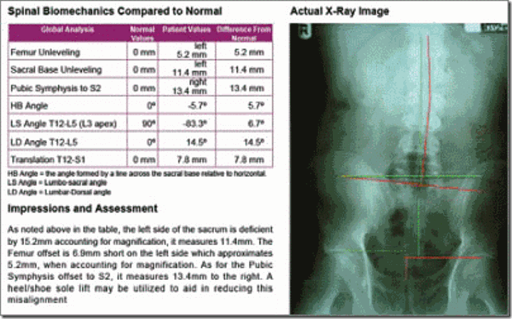 PostureRay®: You’ve Got X-rays, We’ve Got Analysis! - American Journal ...